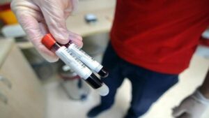 Lipaz yüksekliği neden olur, tedavisi nasıldır? Kandaki lipaz(LPS ...